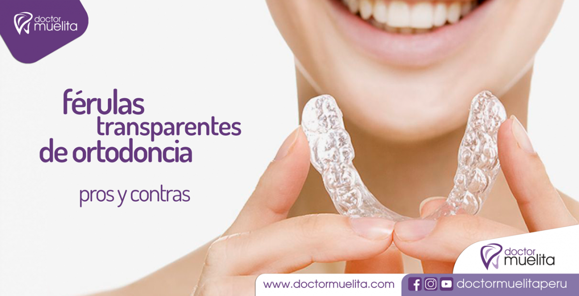 férulas dentales archivos - Clínica Doctor Muelita