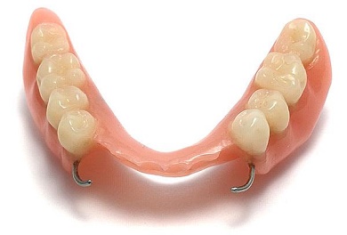 protesis-parcial-removible-1 - Doctor Muelita