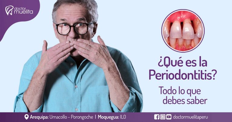 ¿Qué es la Periodontitis?, todo lo que debes saber - Doctor Muelita