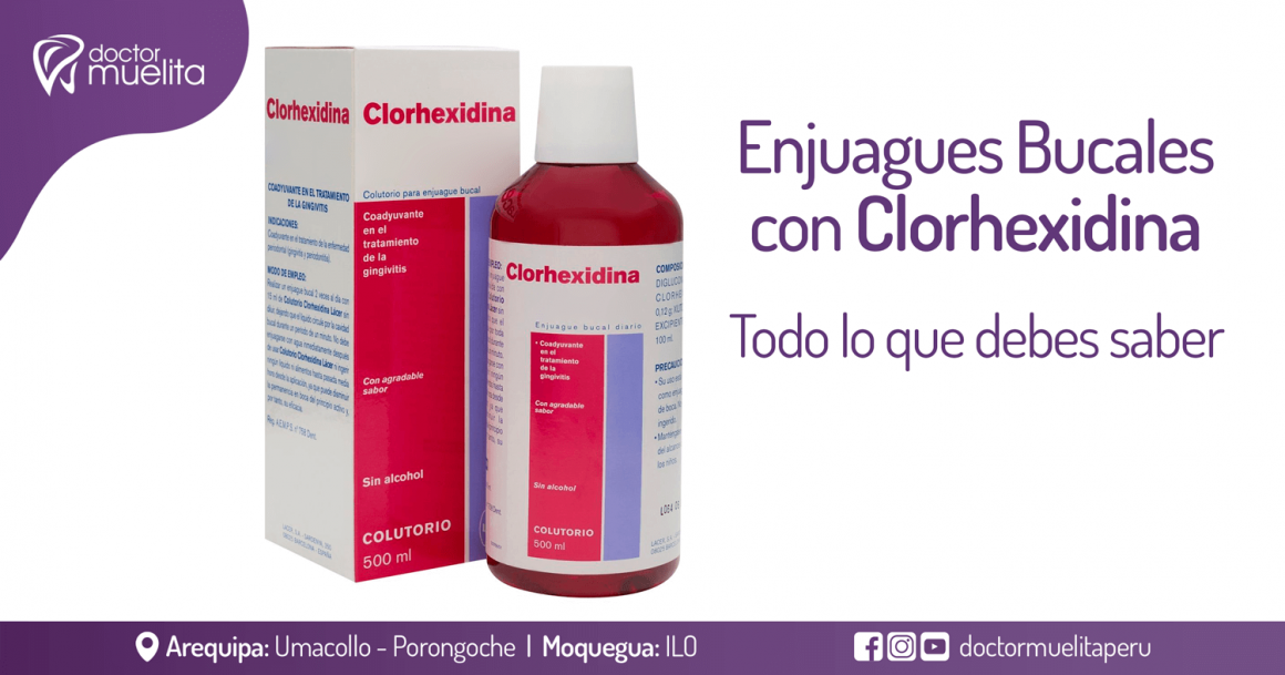 Enjuagues Dentales con Clorhexidina, todo lo que debes saber - Doctor ...
